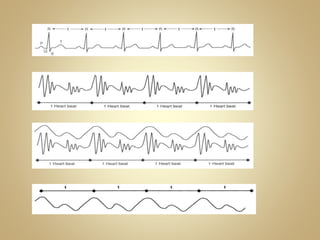 Cardiotocograph.pptx