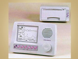 Cardiotocograph.pptx