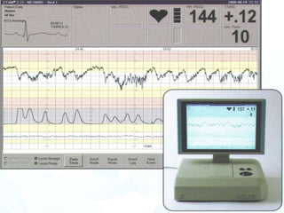 Cardiotocograph.pptx