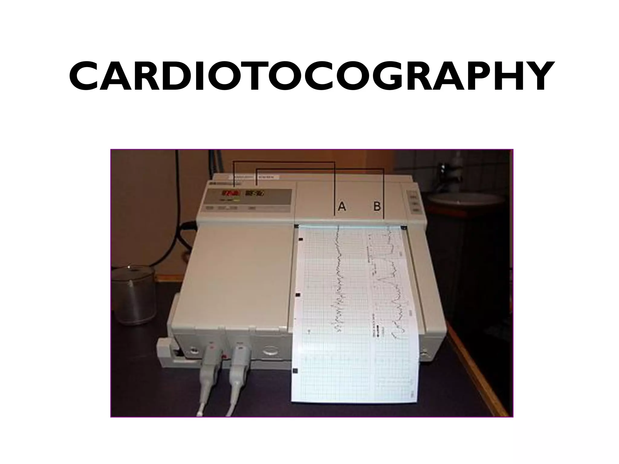 Cardiotocography | PDF