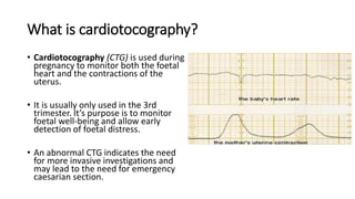 Cardiotocography | PPTX | Pregnancy | Reproductive Health