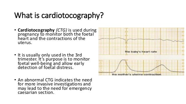 Cardiotocography