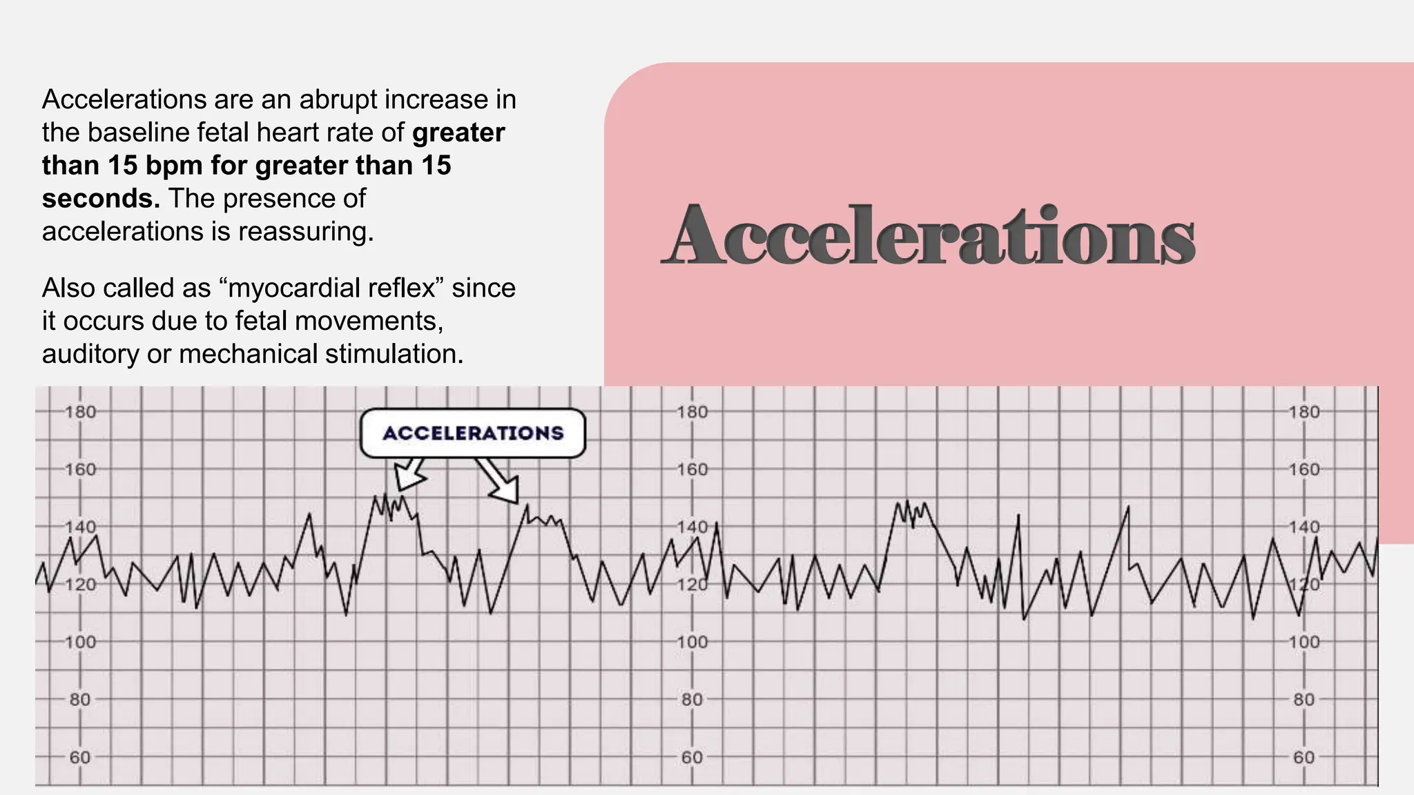 Cardiotocography A FETAL HR MONITORING METHOD | PPTX