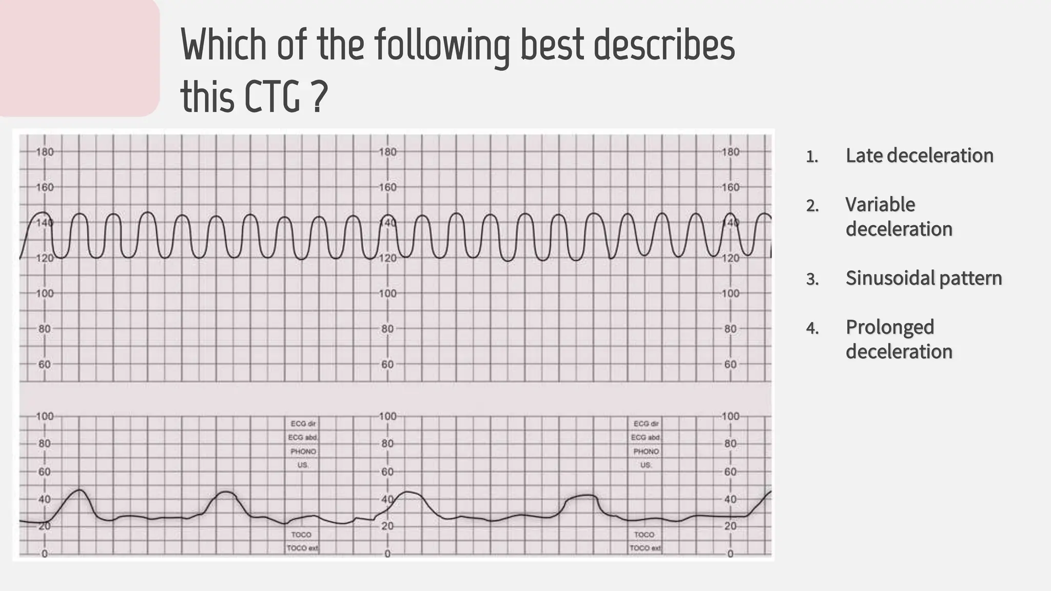 Cardiotocography A FETAL HR MONITORING METHOD | PPTX