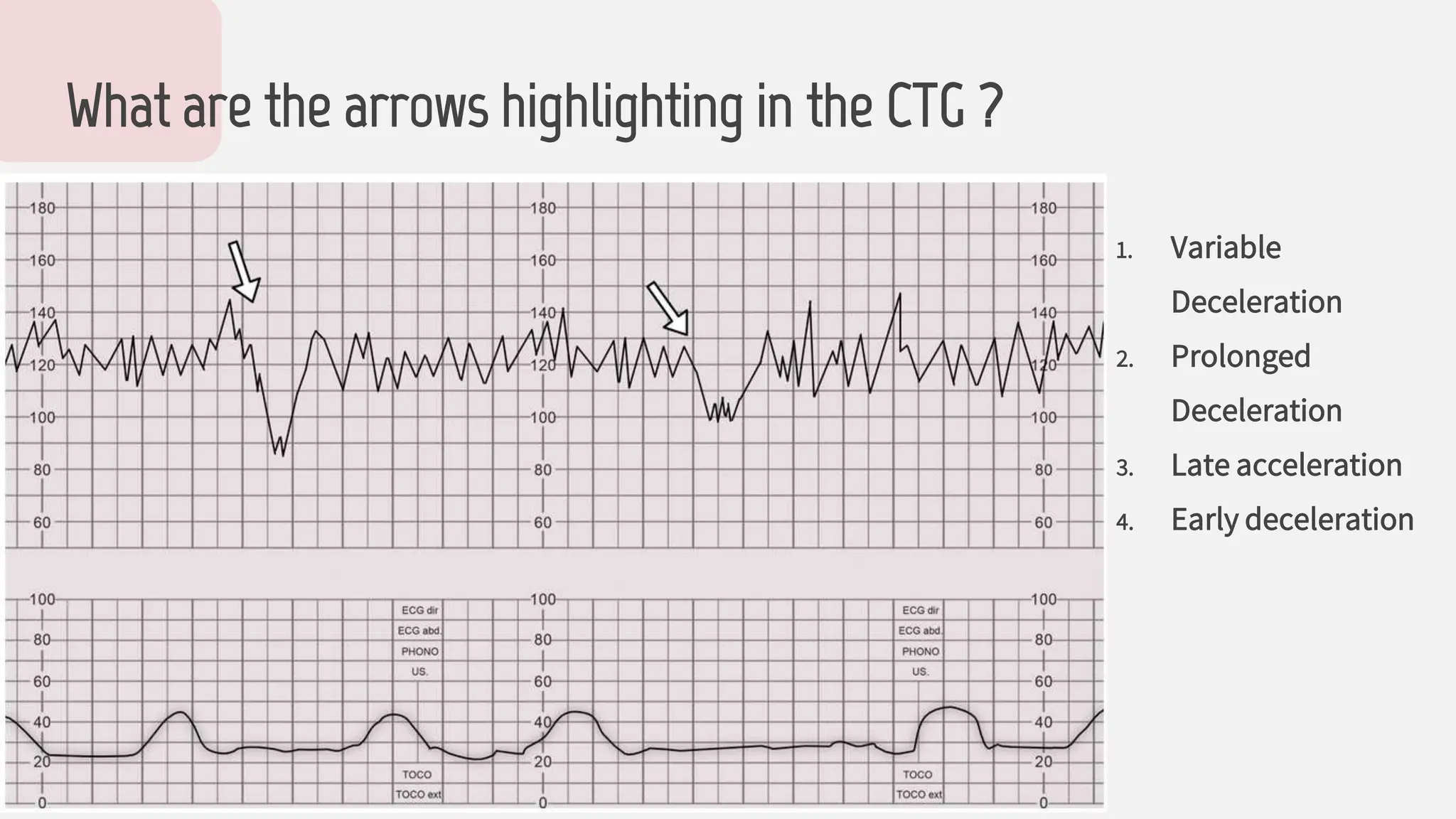 Cardiotocography A FETAL HR MONITORING METHOD | PPTX