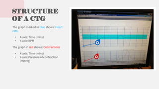 Cardiotocography A FETAL HR MONITORING METHOD | PPT