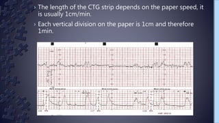 Cardiotocography | PPTX