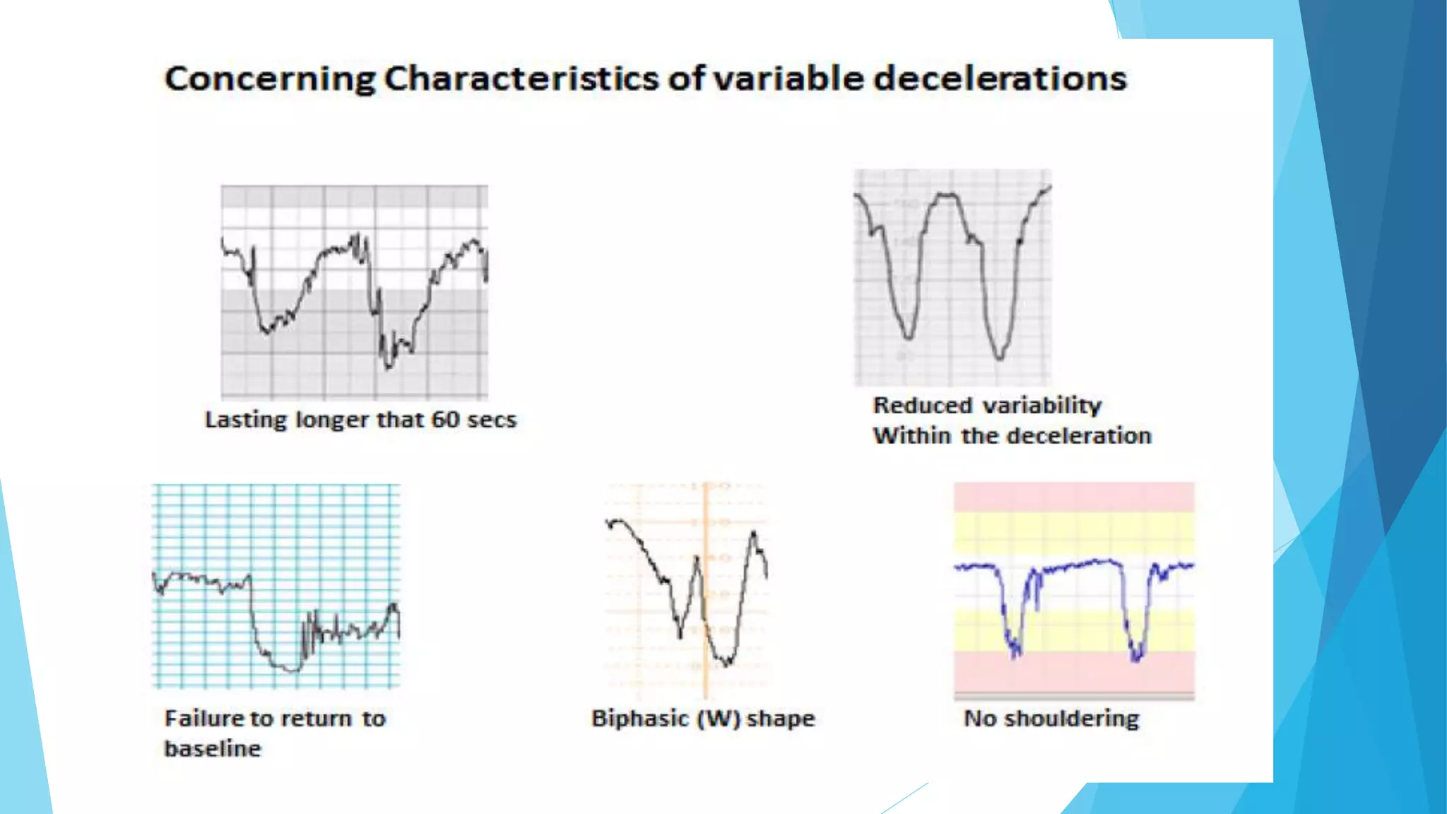 Cardiotocography | PPTX