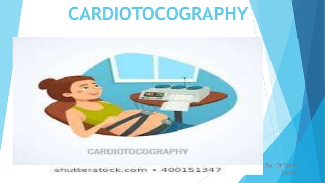 Cardiotocography | PPTX | Pregnancy | Reproductive Health
