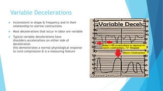 Cardiotocography | PPTX
