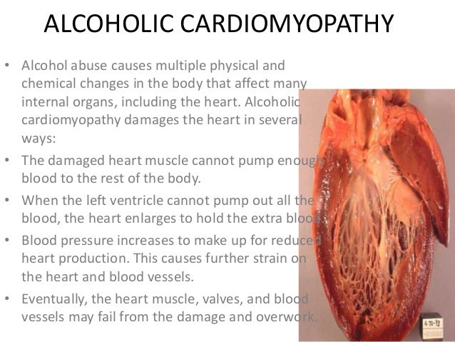 Cardiotoxic chemicals (an Overview)- by Dr.Namrata Mohan