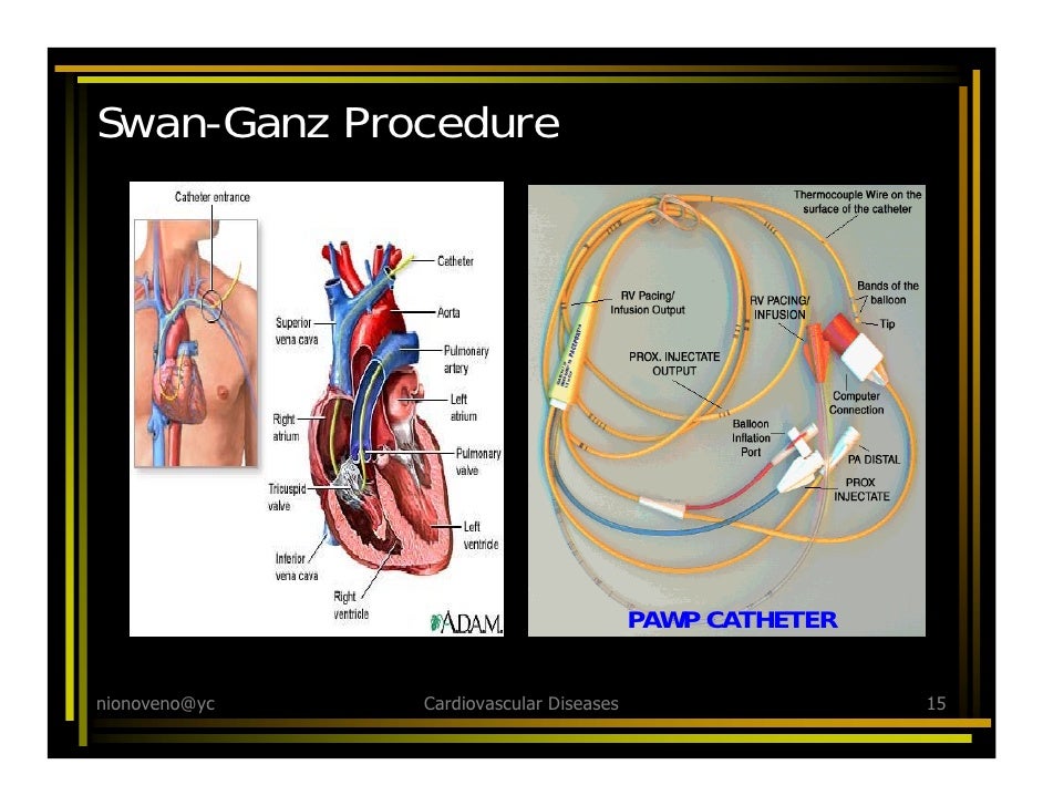 Cardiovascular Disorders Proper
