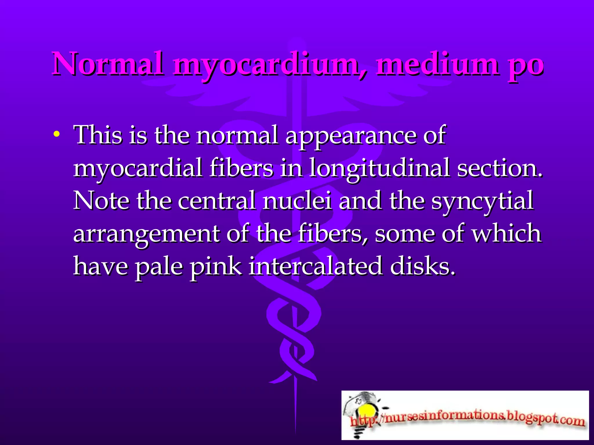 Cardiovascular Pathology (part 1) | PPT