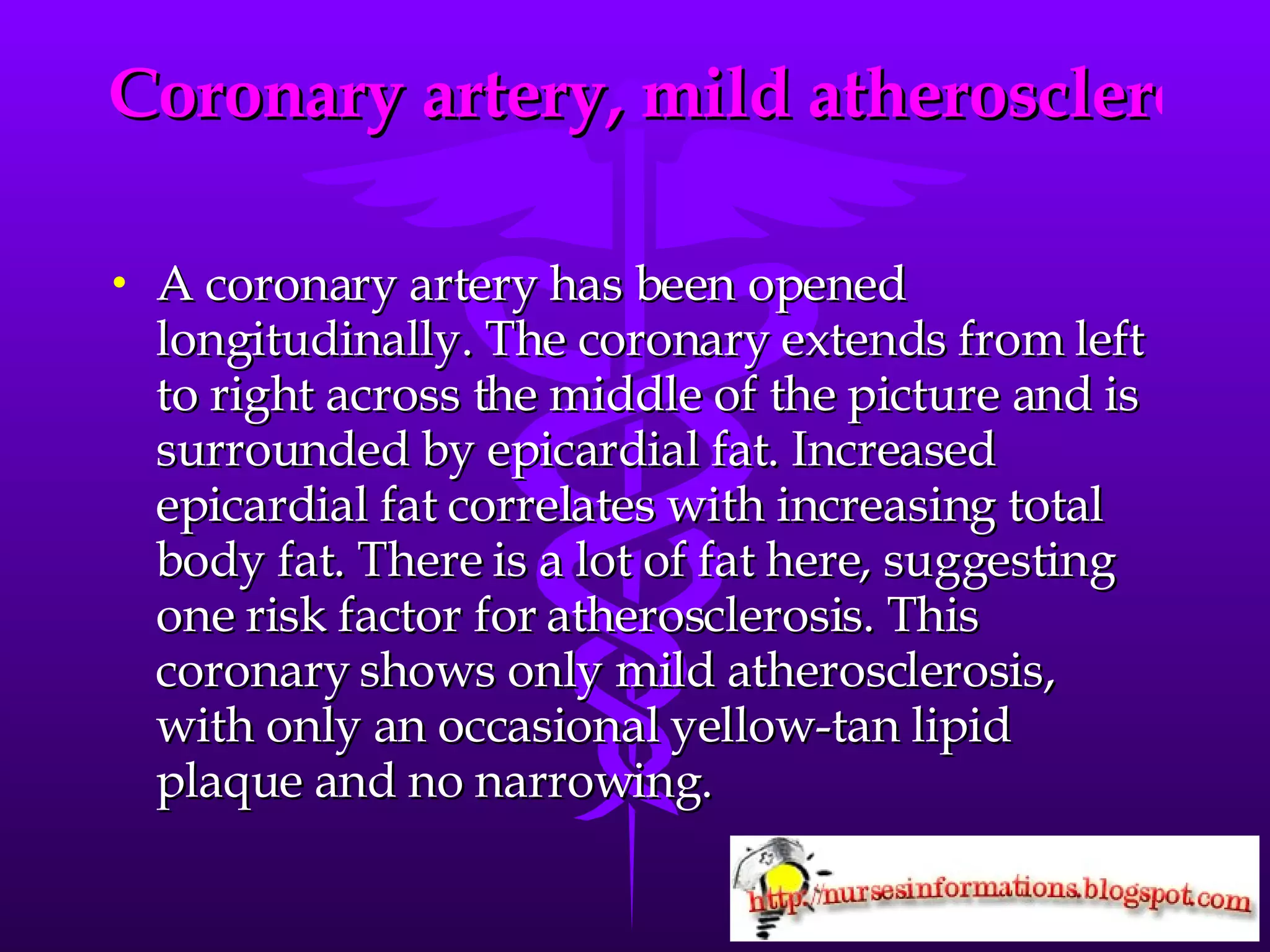 Cardiovascular Pathology (part 1) | PPT | Heart and Cardiovascular ...