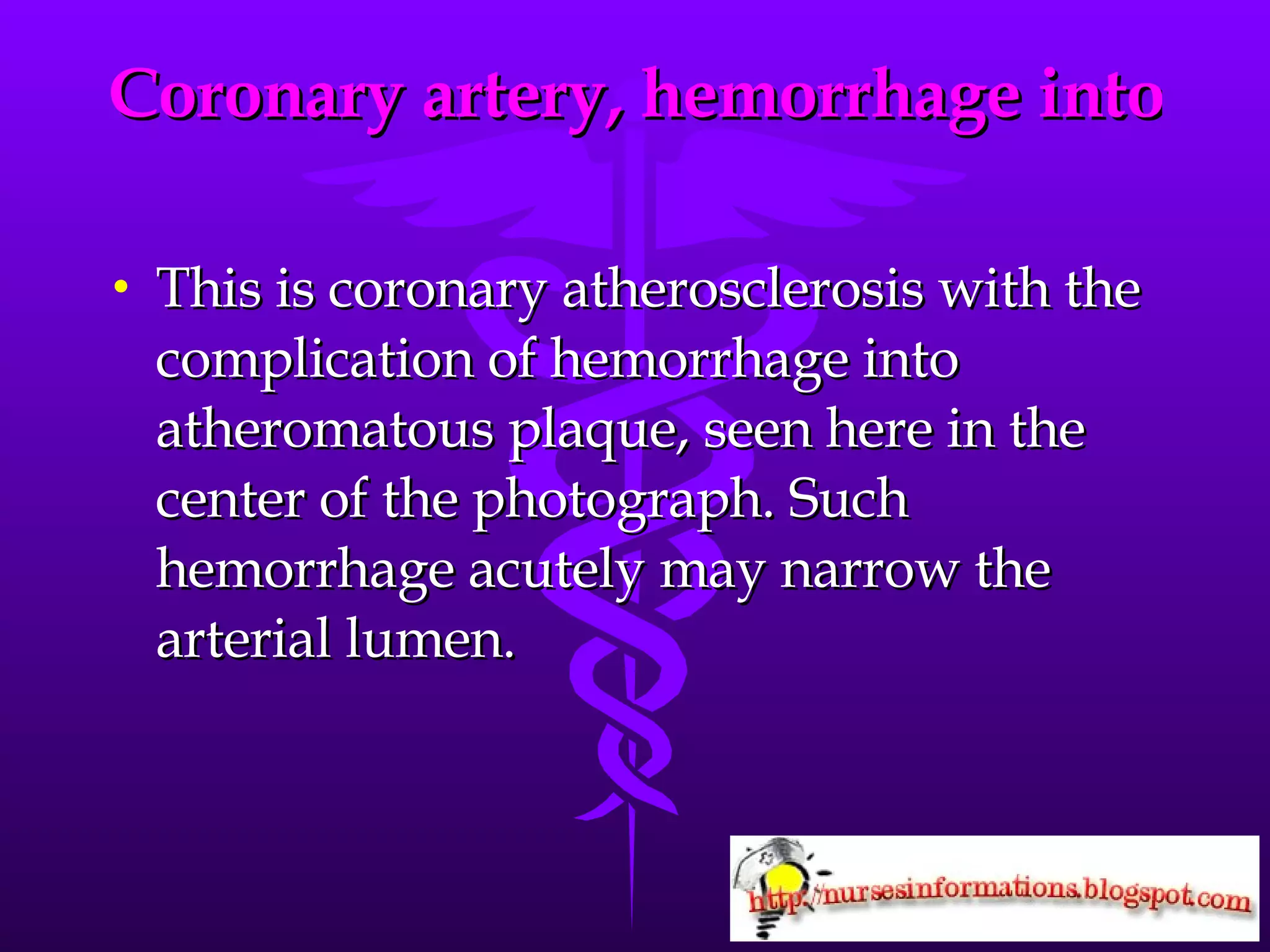 Cardiovascular Pathology (part 1) | PPT