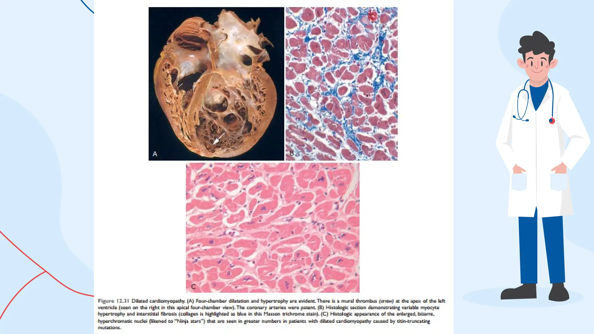 Cardiovascular system PAtologi anatomi.pptx