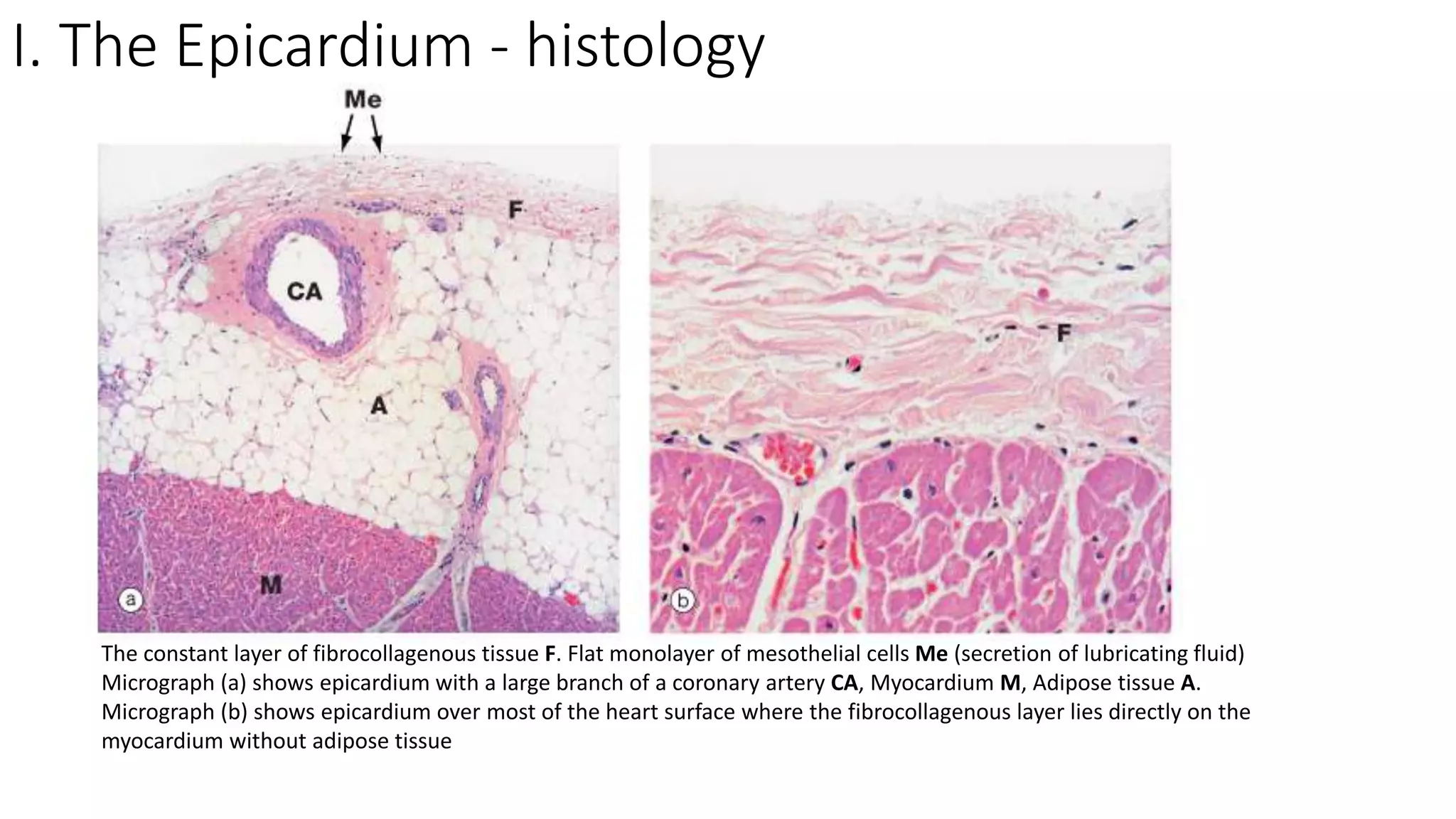 Epicardium Histology Slide