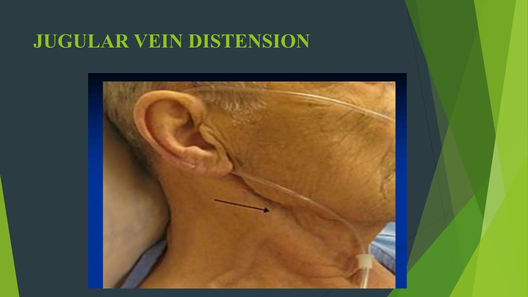cardiovascular and peripheral assessment.pptx