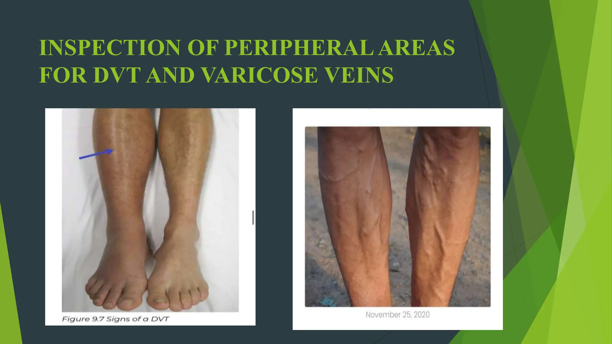 cardiovascular and peripheral assessment.pptx