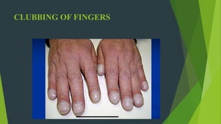 cardiovascular and peripheral assessment.pptx