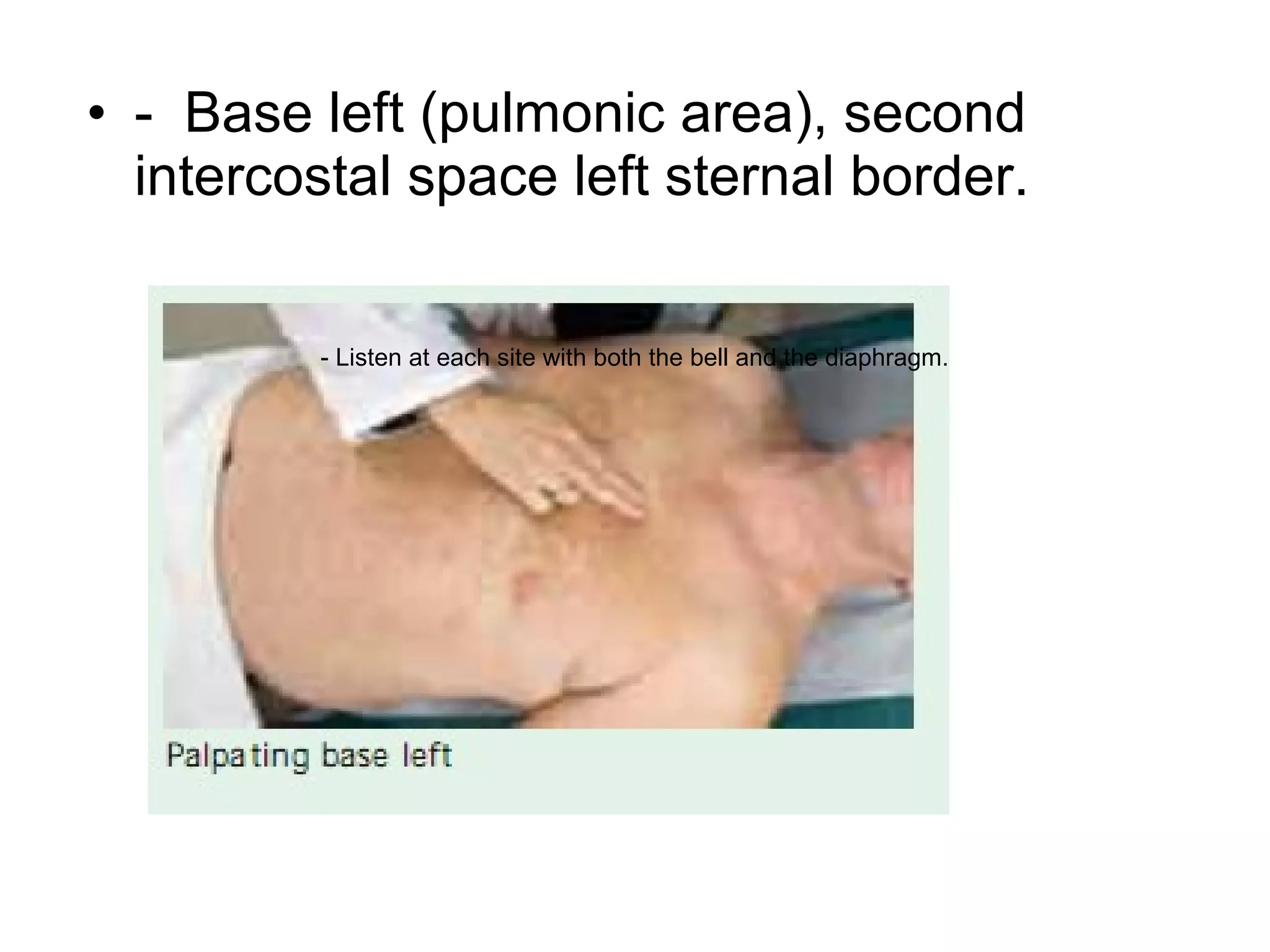 Cardiovascular assessment | PPT