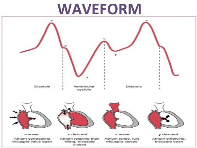 Cardio vascular assessment