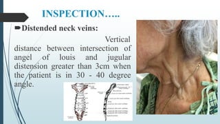 HEALTH ASSESSMENT CARDIOVASCULAR ASSESSMENT.pptx