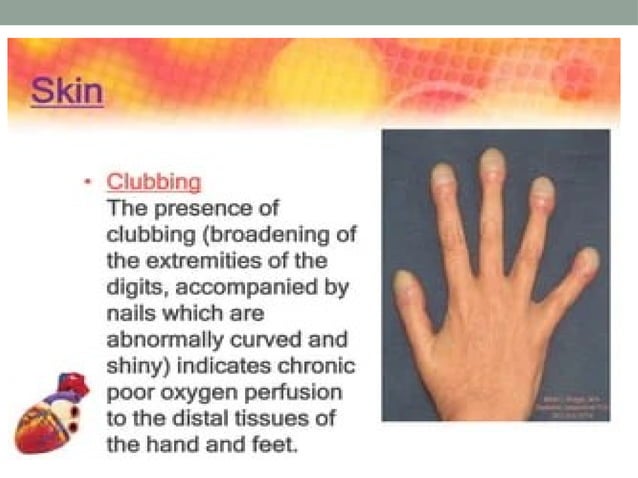 Cardiovascular assessment for nurses.pptx