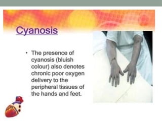 Cardiovascular assessment for nurses.pptx