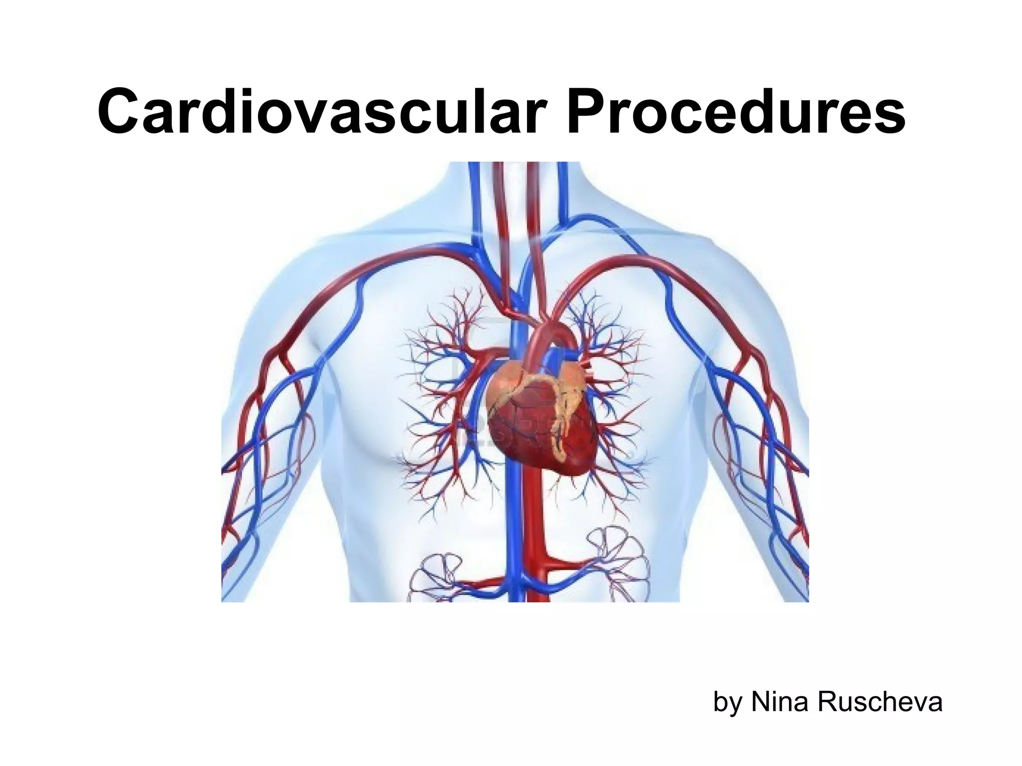 Cardiovascular diagnostic procedures | PPT