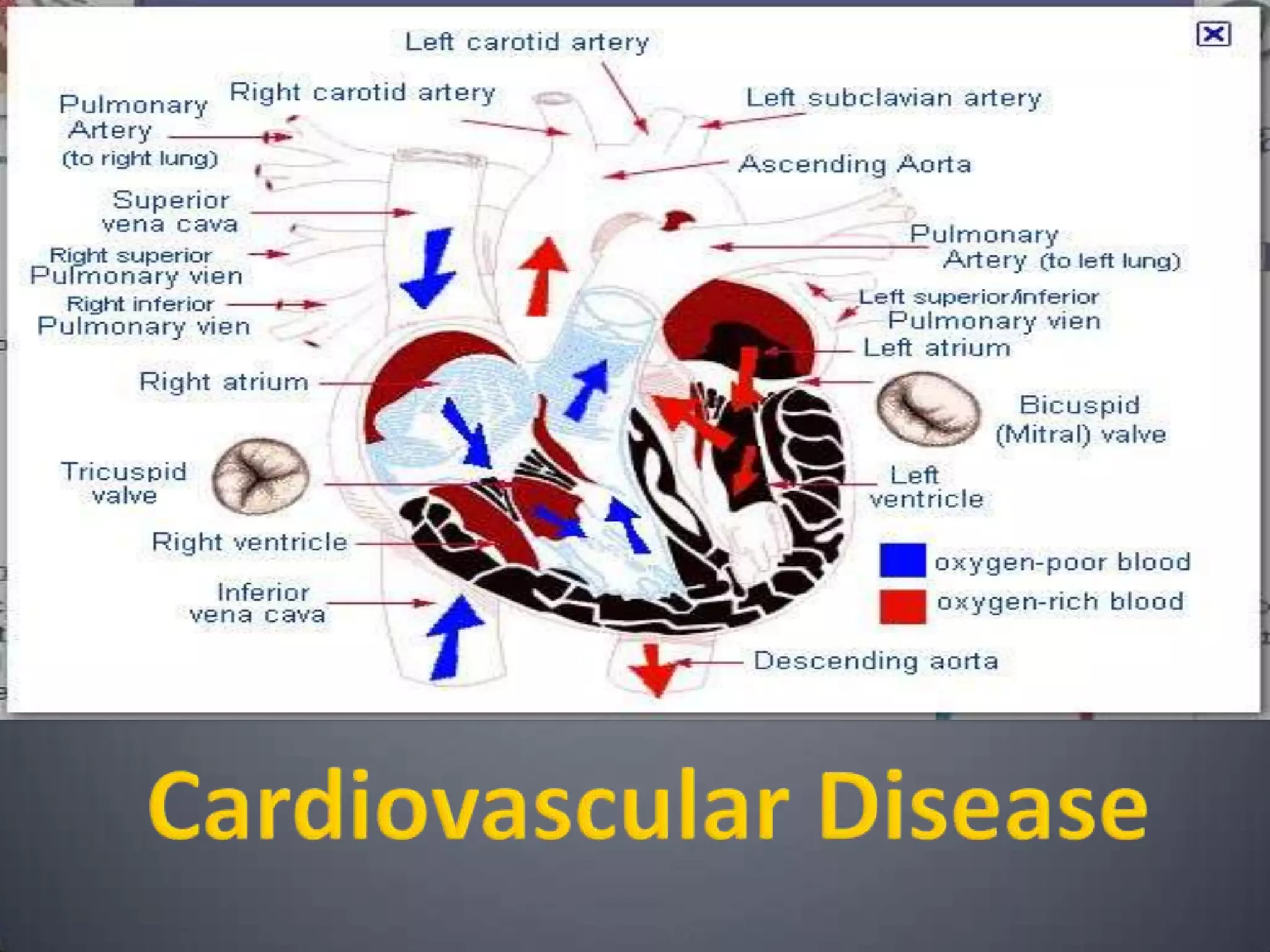 Cardiovascular disease | PPT
