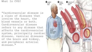 Cardiovascular disease(cvd) | PPTX