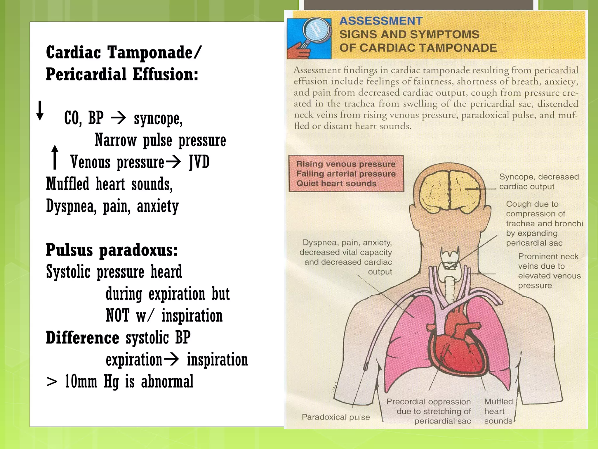 Cardiovascular disease, interventions and care | PPT