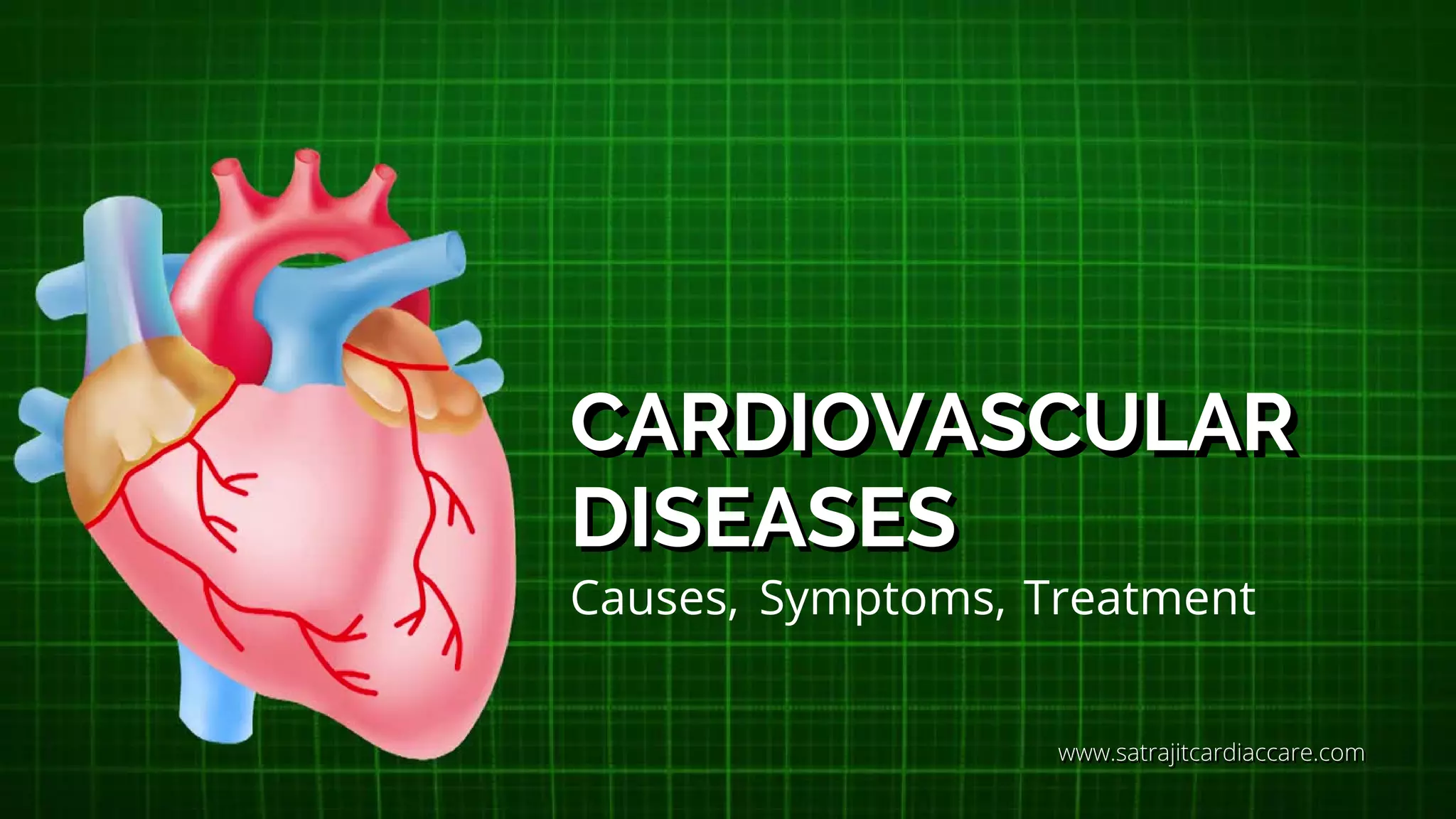 Cardiovascular diseases- Causes, Symptoms & Treatment - Satrajit ...