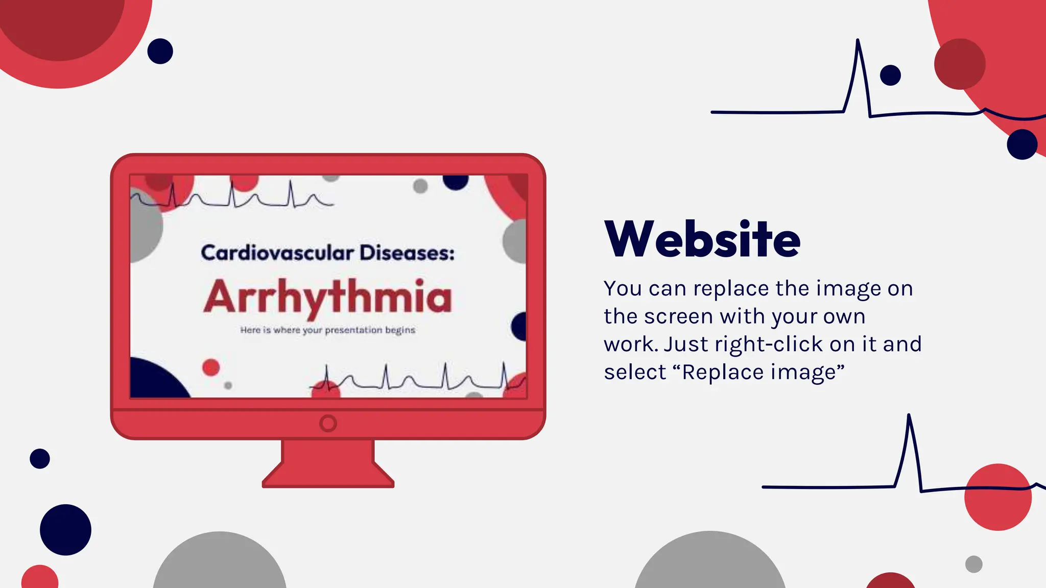 Cardiovascular Diseases_ Arrhythmia by Slidesgo.pptx