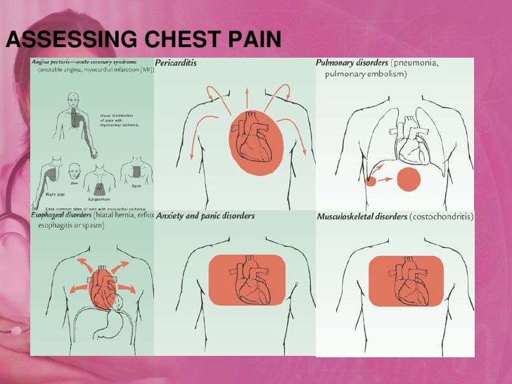 Cardiovascular diseases modified