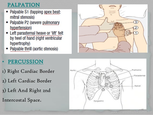 Cardiovascular diseases & Dental Management