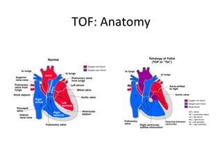 Cardiovascular disorders | PPT