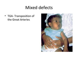 Cardiovascular disorders | PPT