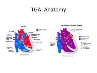 Cardiovascular disorders | PPT