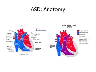 Cardiovascular disorders | PPT