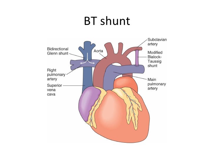 Cardiovascular disorders
