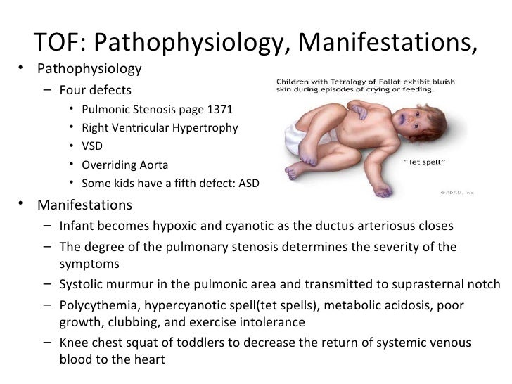 Cardiovascular disorders