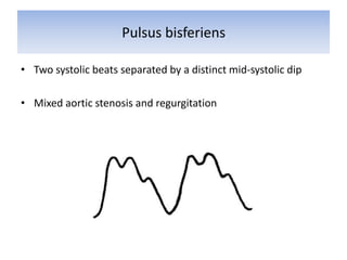 Cardiovascular examination | PPT
