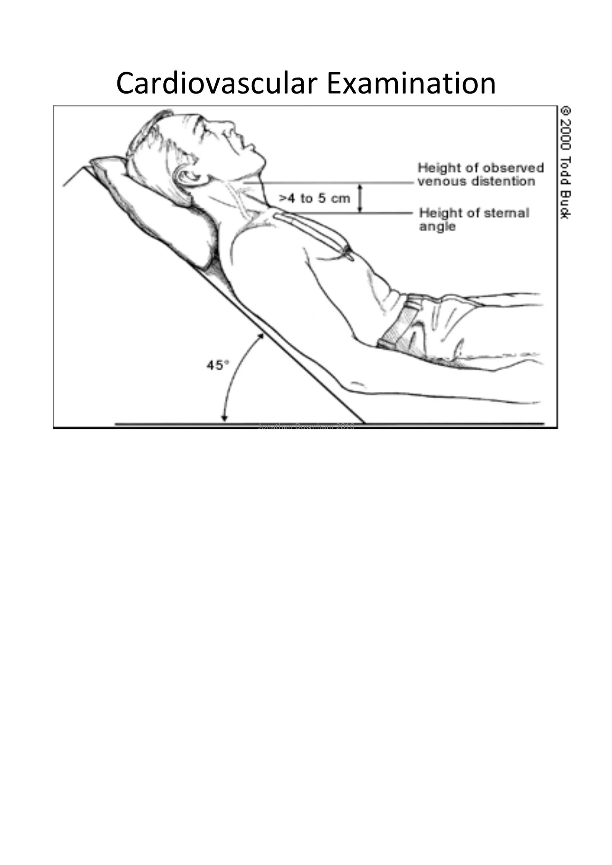 Cardiovascular examination | PDF