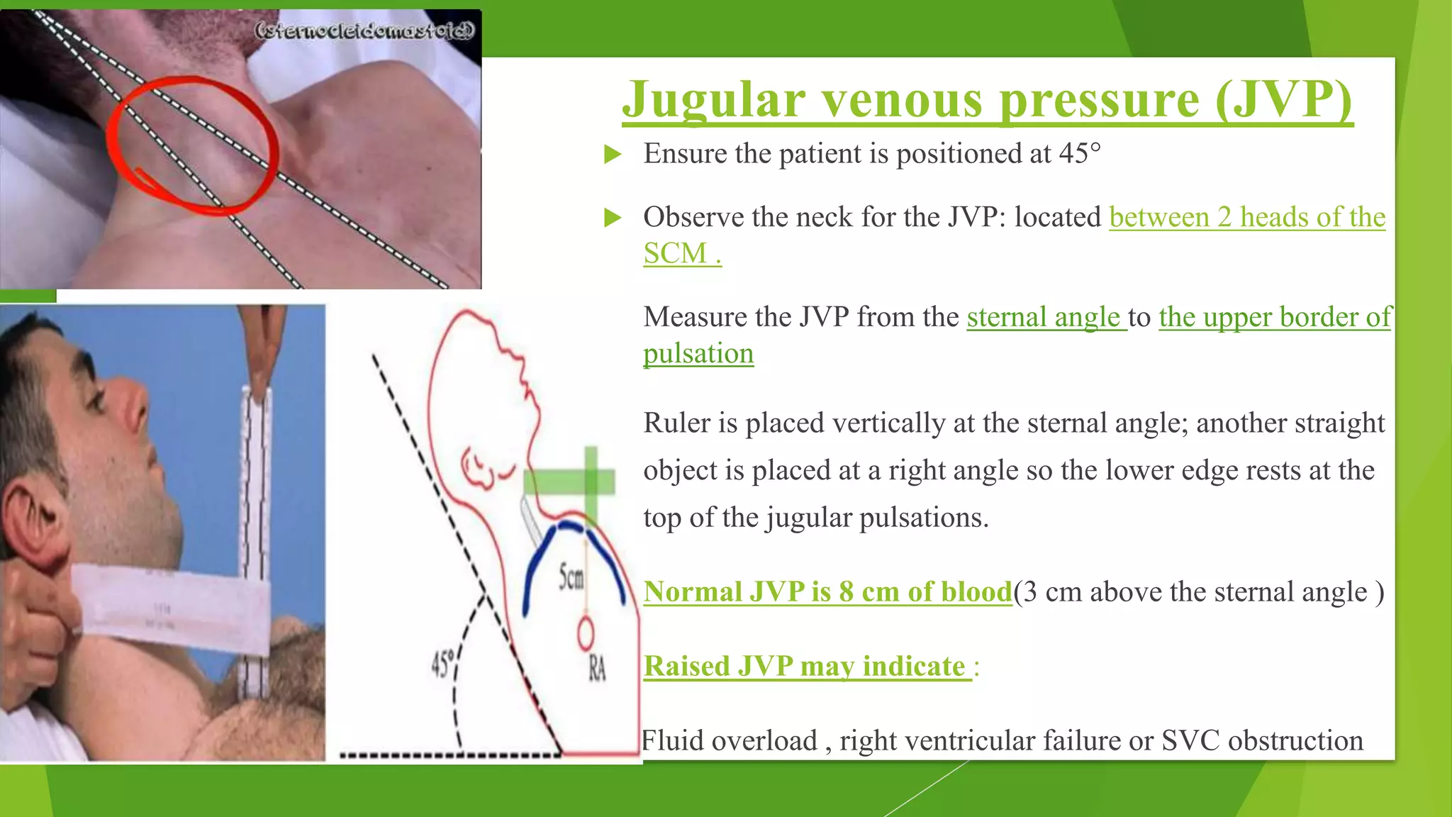 Cardiovascular examination | PPTX