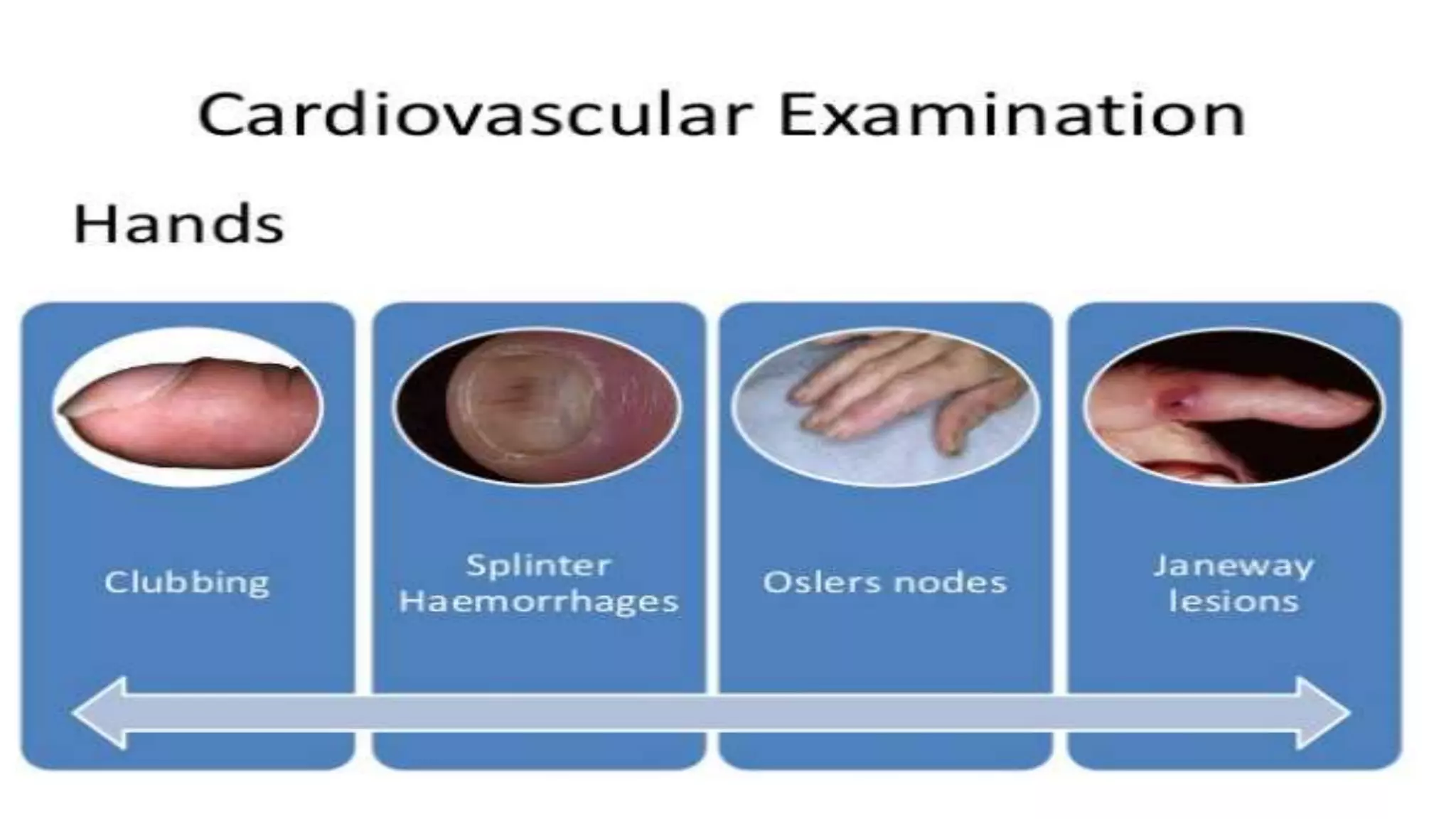 Cardiovascular examination | PPTX