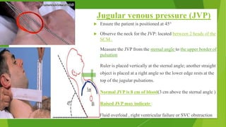 Cardiovascular examination | PPTX