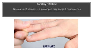 Cardiovascular examination | PPTX