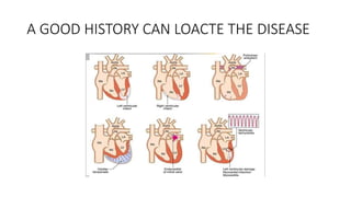 Cardiovascular history taking | PPTX